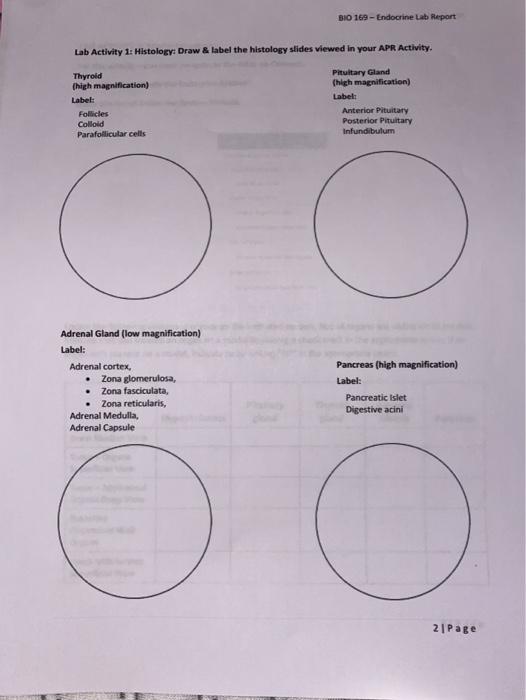 Solved BIO 169 - Endocrine Lab Report Lab Activity 1: | Chegg.com