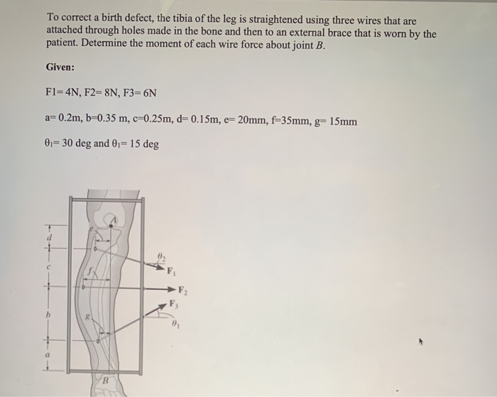Solved To correct a birth defect, the tibia of the leg is | Chegg.com