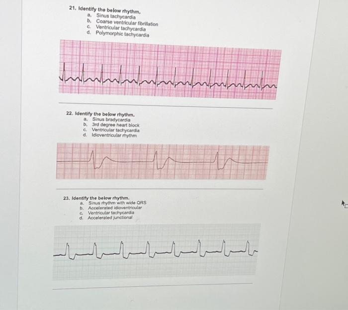 Solved 21. Identify the below rhythm. a, Sinus tachycardia | Chegg.com