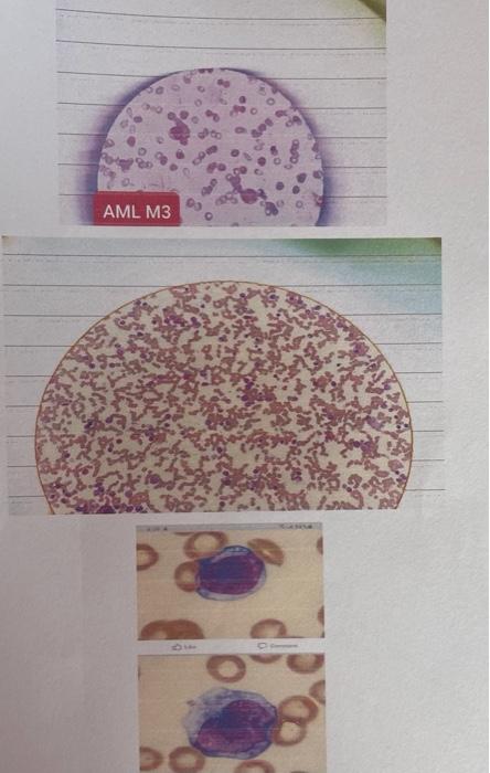 Solved AML M3 D DO Dr | Chegg.com