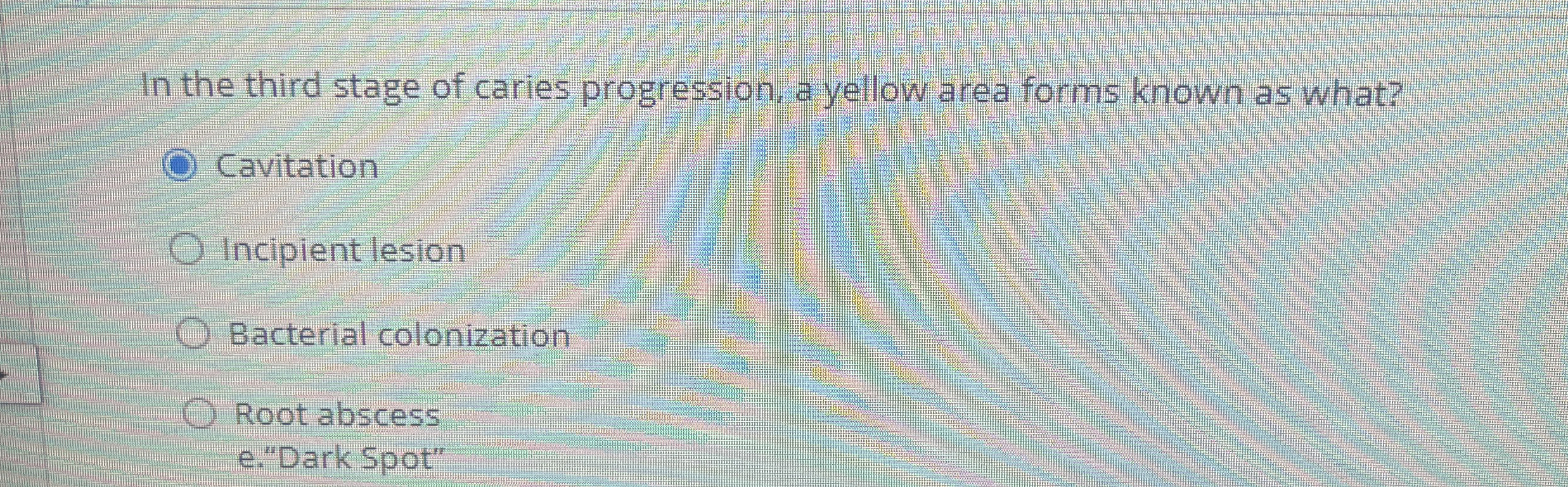 Solved In the third stage of caries progression, a yellow | Chegg.com