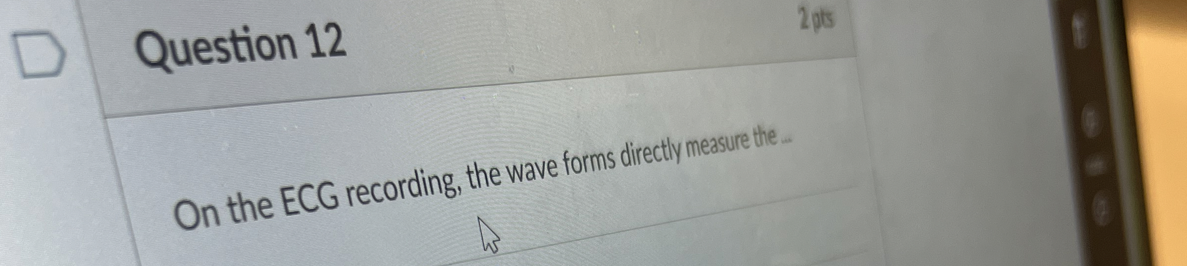 Solved Question 12On the ECG recording, the wave forms | Chegg.com