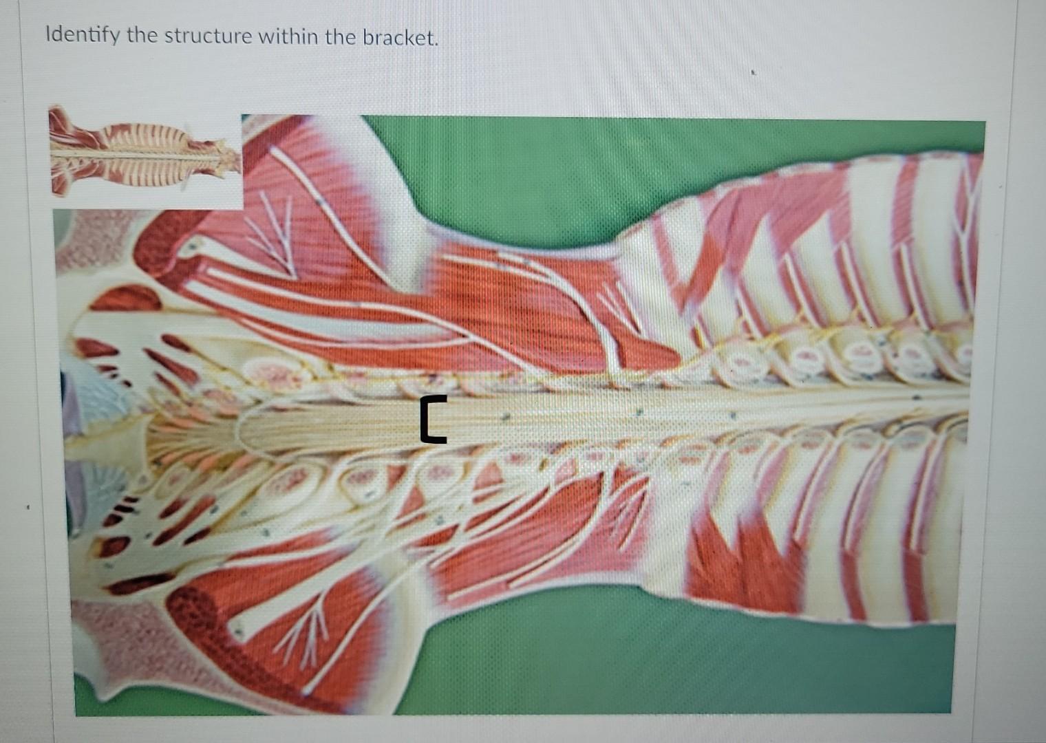 Solved Identify the structure at the tip of the | Chegg.com