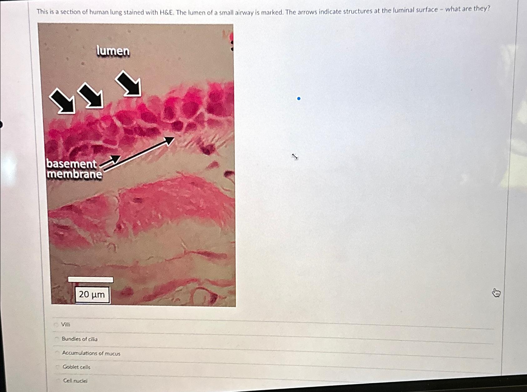 Solved This is a section of human lung stained with H&E. | Chegg.com