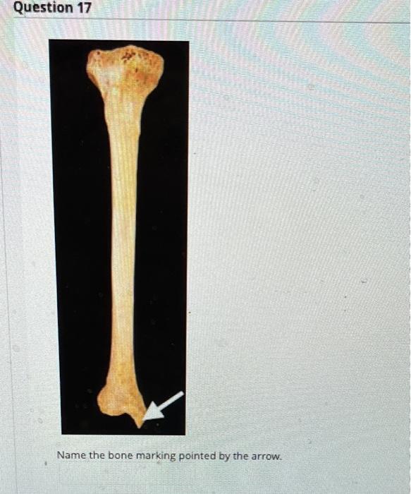 Solved Question 17 Name the bone marking pointed by the | Chegg.com