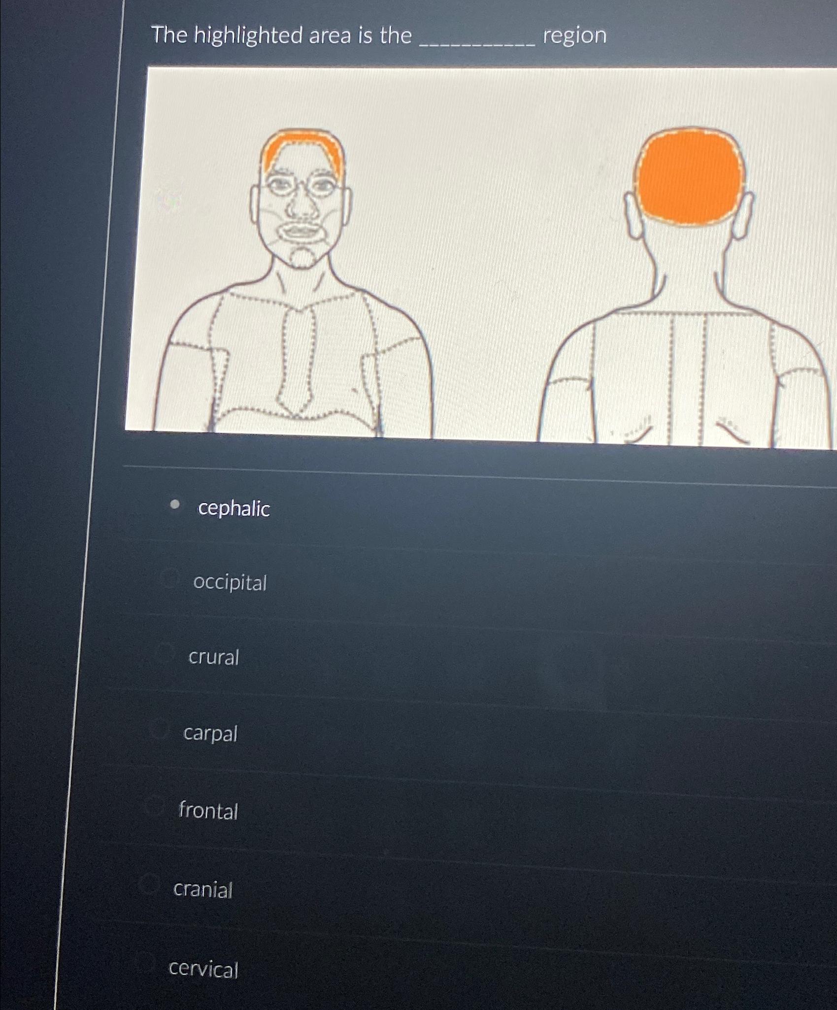 The highlighted area is the | Chegg.com