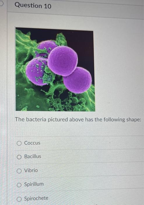 Solved The bacteria pictured above has the following shape: | Chegg.com