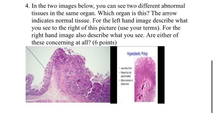 Solved 4. In the two images below, you can see two different | Chegg.com