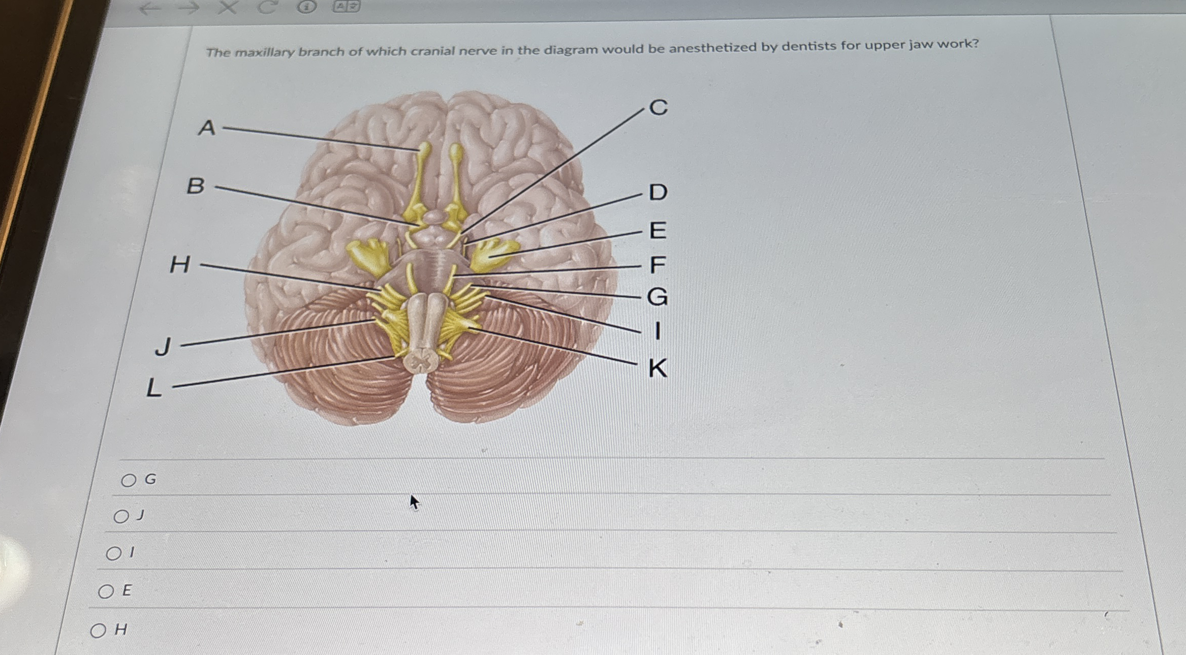 Solved The maxillary branch of which cranial nerve in the | Chegg.com