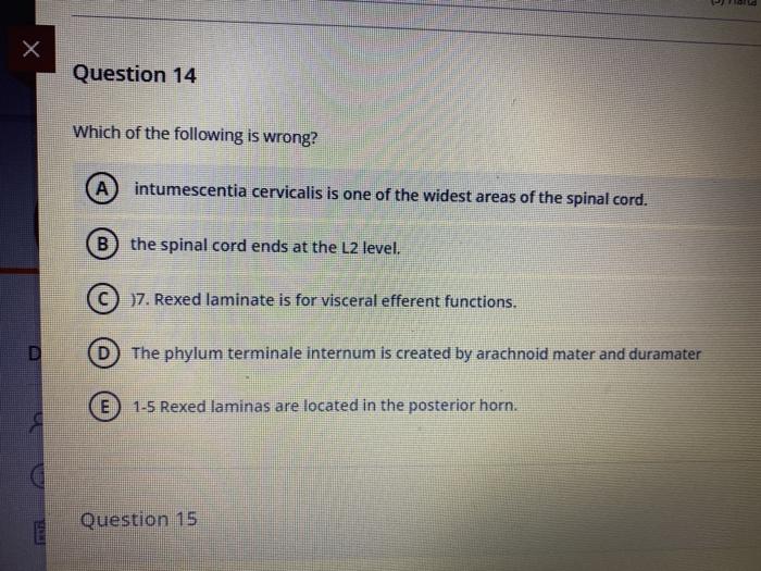 Solved Question 14 Which of the following is wrong? A | Chegg.com