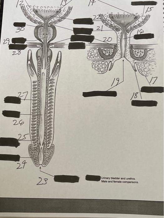 Solved 1. Bulbourethral gland (Cowper's gland) 2. Corpus | Chegg.com
