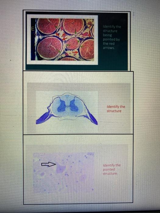 Solved Identify the structure being pointed by the red | Chegg.com Solved Identify the structure being pointed by the red | Chegg.com