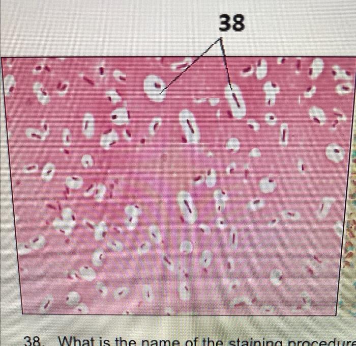 Solved 38 40 00 38. What is the name of the staining | Chegg.com