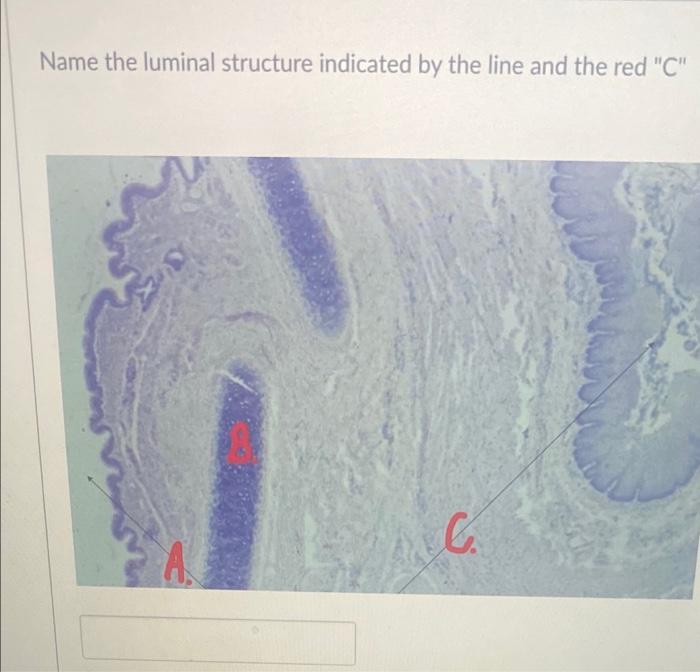 Solved Name the luminal structure indicated by the line and | Chegg.com