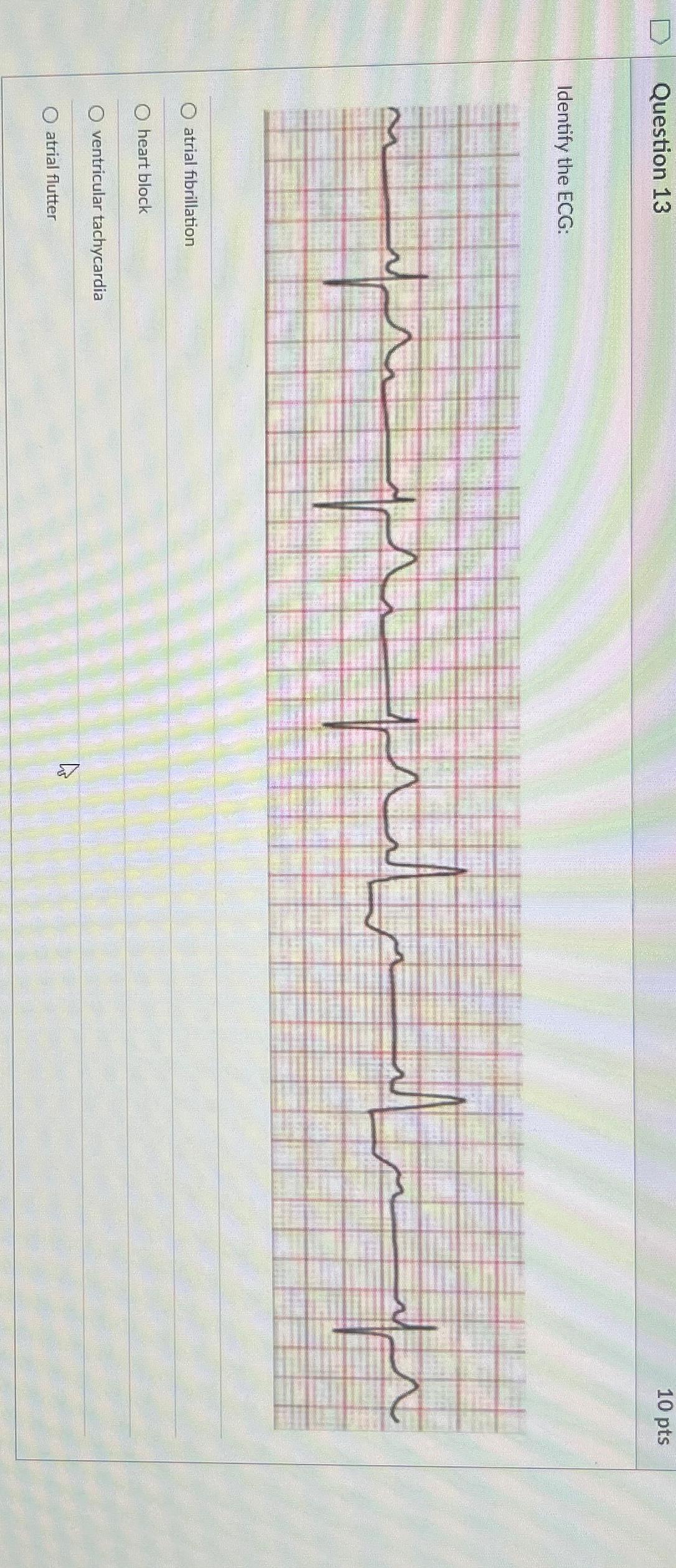 Solved Question 1310ptsIdentify the ECG:atrial | Chegg.com