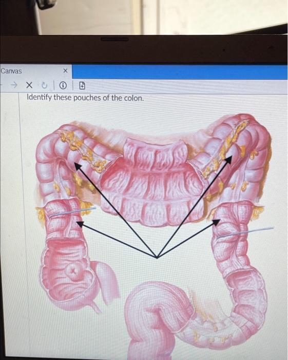 Solved Canvas → X D Identify these pouches of the colon. | Chegg.com