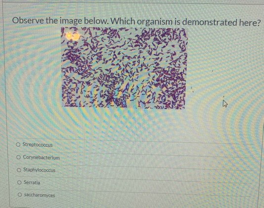 Solved An example of an Exoenzyme that can be easily tested | Chegg.com