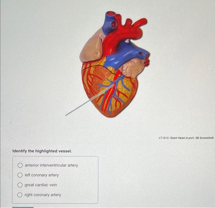 Solved Identify the highlighted vessel. anterior | Chegg.com