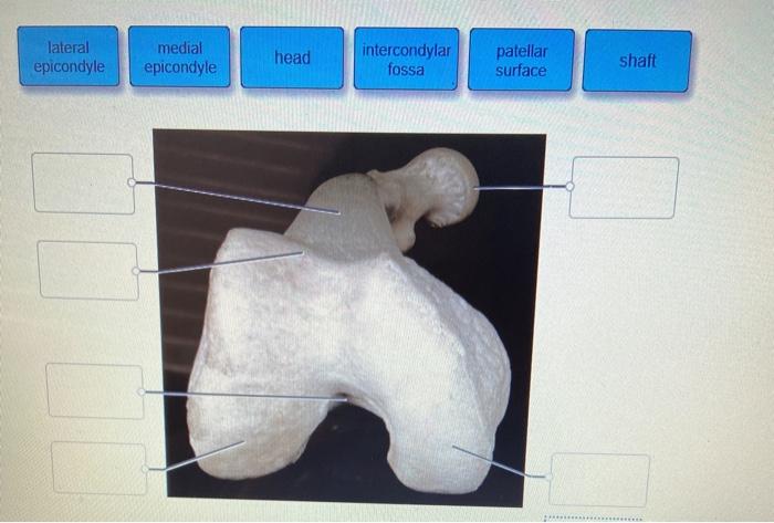 Solved Identify the anatomical structures shown in the | Chegg.com Solved Identify the anatomical structures shown in the | Chegg.com