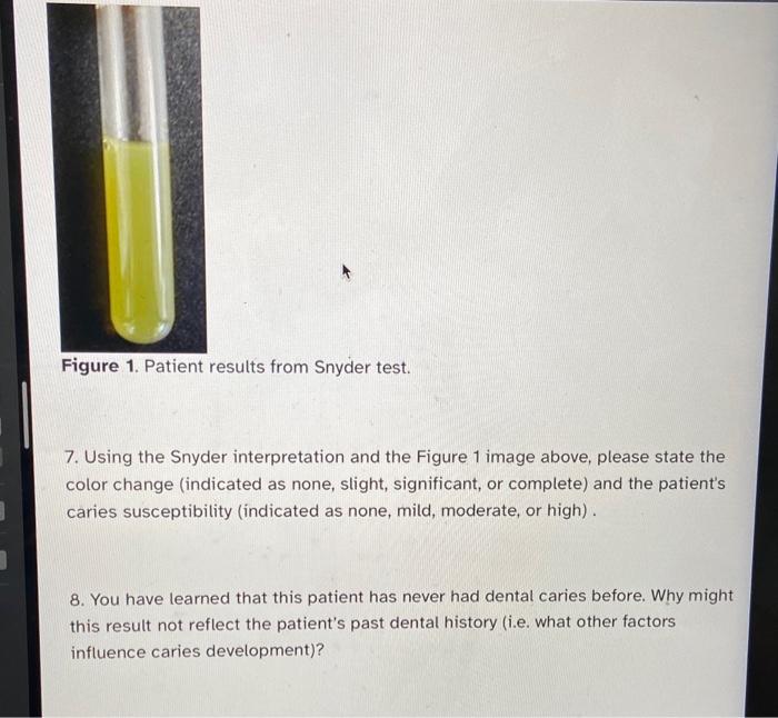 Solved Snyder interpretation: 2 3 3 5 SP se Tube 1: | Chegg.com