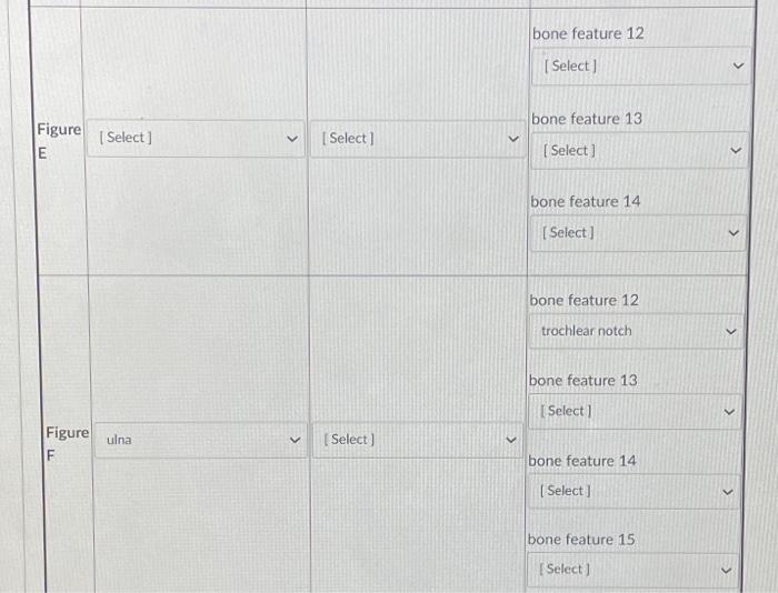 Label the upper limb bone \& portion | Chegg.com