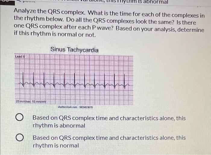 Solved Step 5: Analyze the QRS complex The QRS complex time | Chegg.com