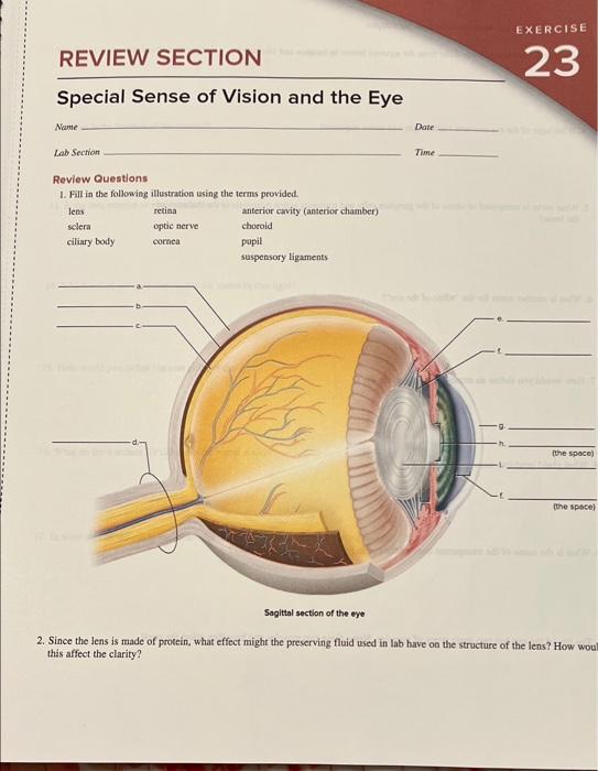 Solved EXERCISE REVIEW SECTION 23 Special Sense of Vision | Chegg.com