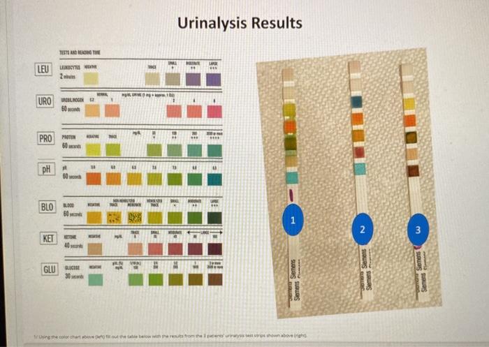 Solved Urinalysis Results TUTI ADRENGTH LEU LICE M. URO | Chegg.com