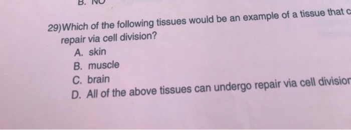 Solved 29) Which of the following tissues would be an | Chegg.com