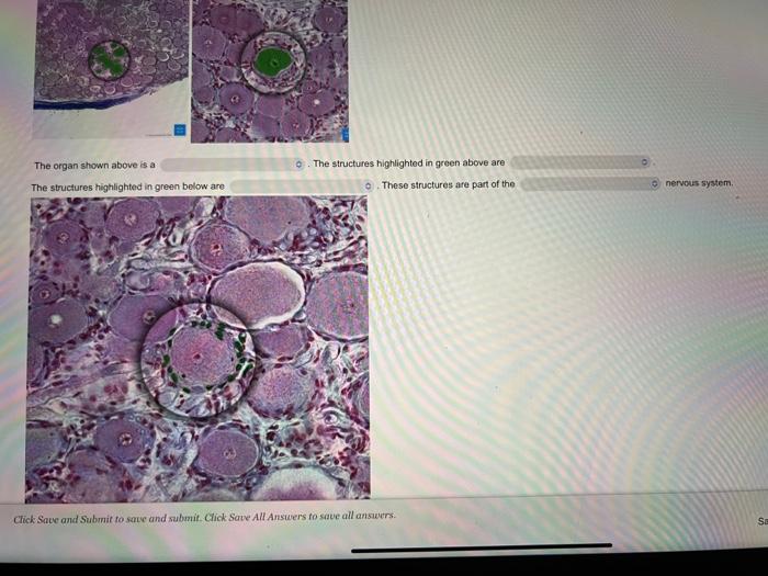 Solved The organ shown above is a The structures highlighted | Chegg.com