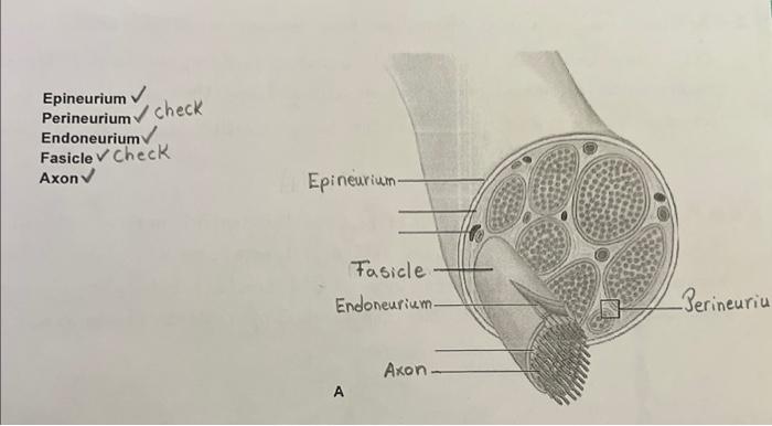 Solved Epineurium Perineurium Check Endoneurium | Chegg.com