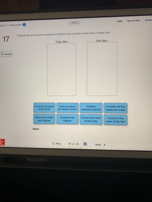 Solved Help Save & Exit Subm Duiz 4. Integument * Classify | Chegg.com