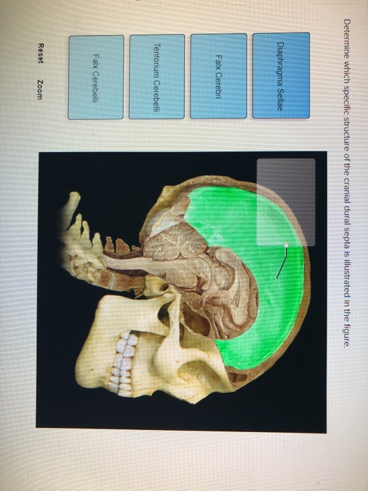 Solved Determine which specific structure of the cranial | Chegg.com