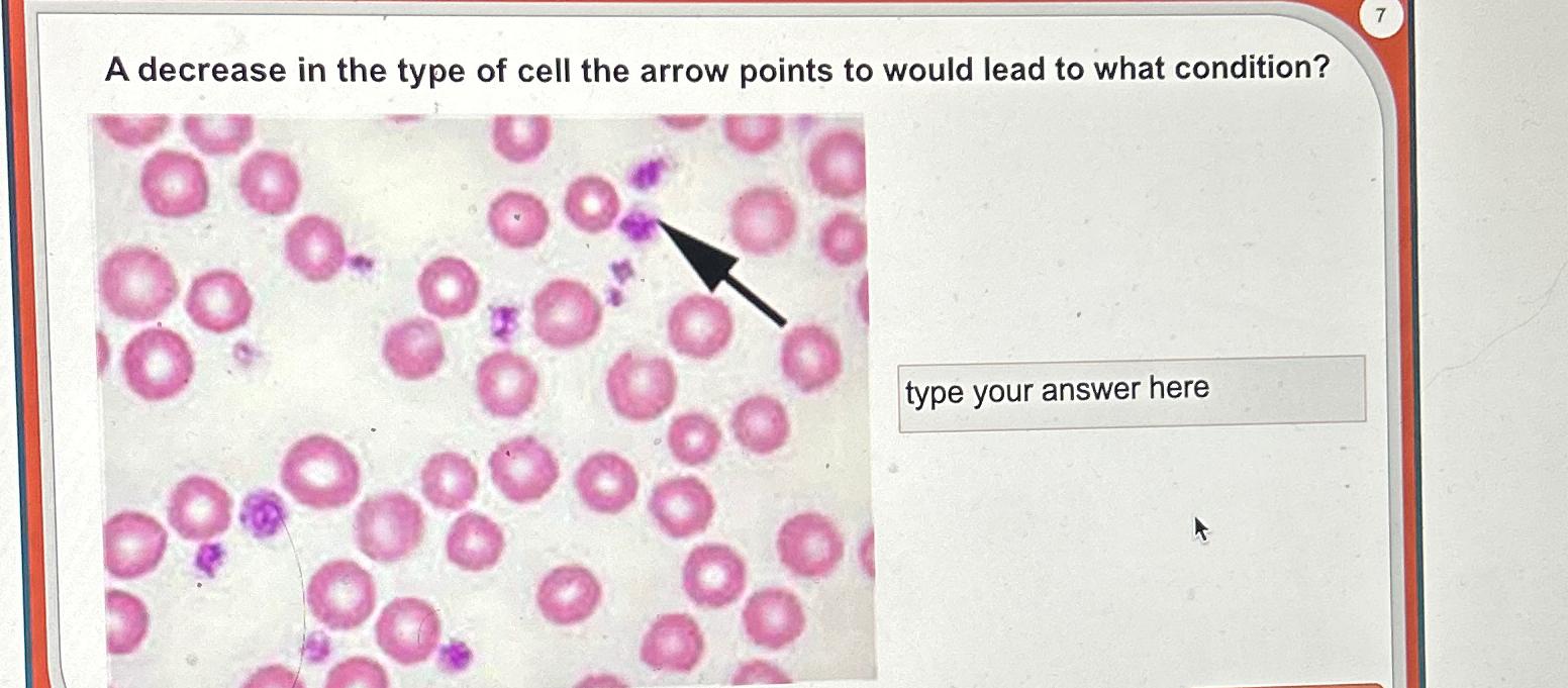 Solved A decrease in the type of cell the arrow points to | Chegg.com