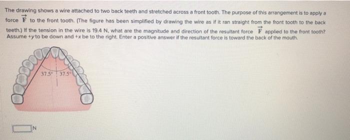 Solved The drawing shows a wire attached to two back teeth | Chegg.com