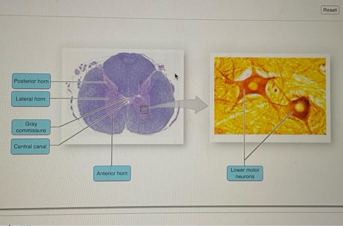Reset Posterior horn Lateral horn Gray commissure | Chegg.com