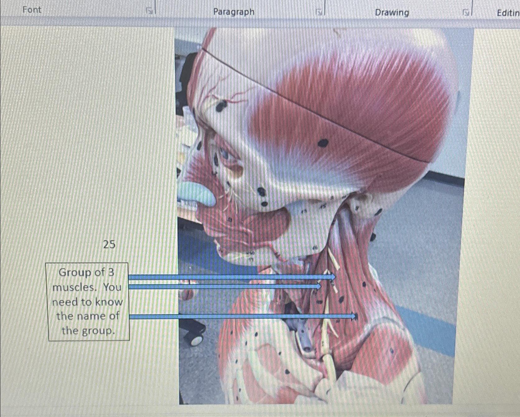 Solved My lab terms sheet has a term under lateral muscles | Chegg.com