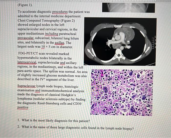 Solved Case 4: (5)ta) of the beik. Ifer paut and receot | Chegg.com