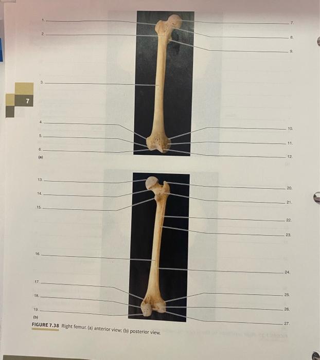 Solved 12. 2 3 4, 5 6. IE. 7. (bone) 8. (bone) 18 . 9. 19. | Chegg.com