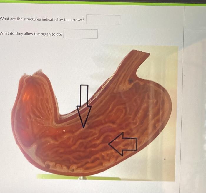 Solved What are the structures indicated by the arrows? What | Chegg.com