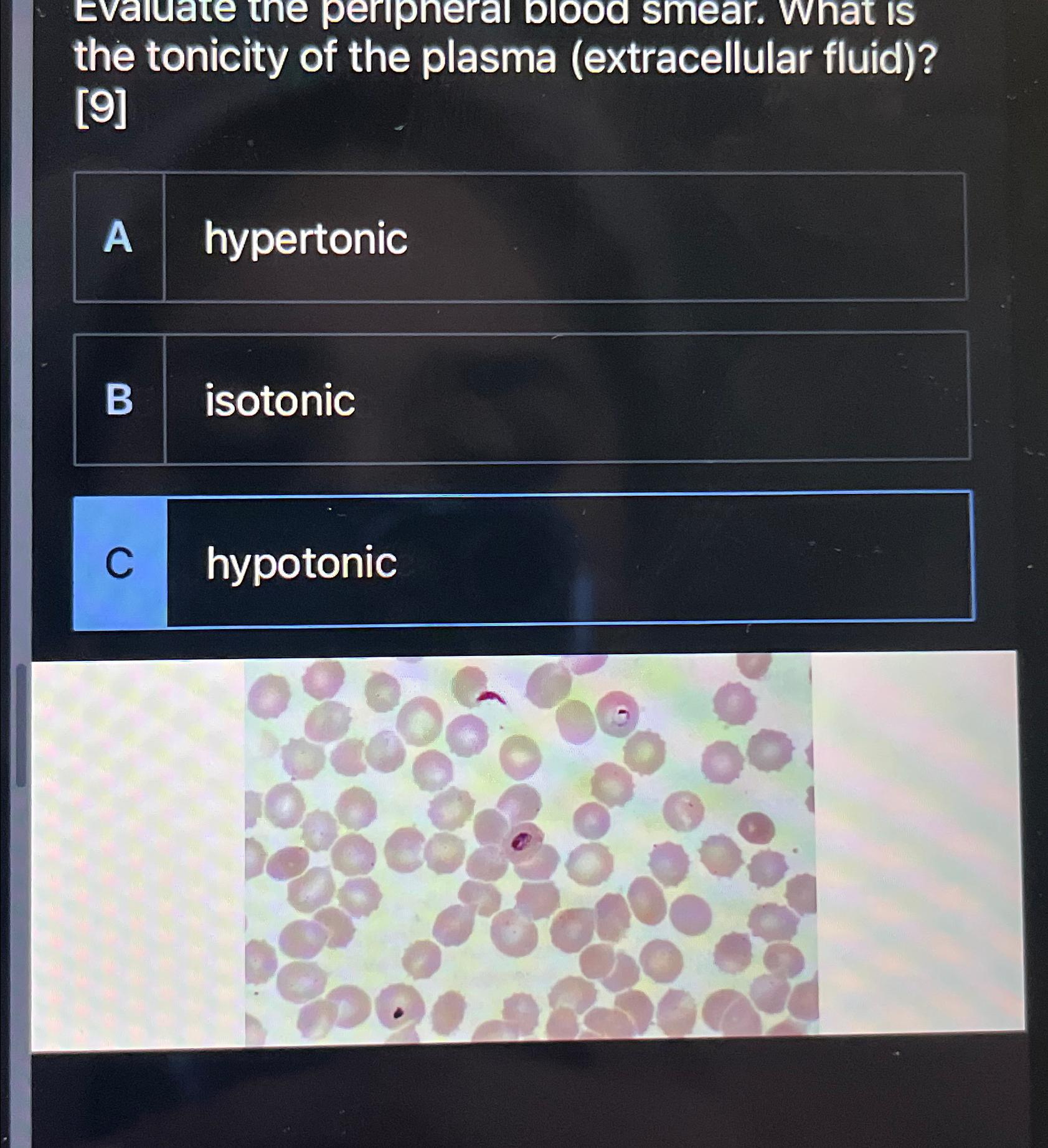 Solved the tonicity of the plasma (extracellular fiud [9]A | Chegg.com