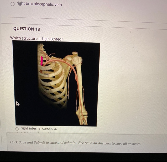 Solved QUESTION 19 Which structure is highlighted? right | Chegg.com