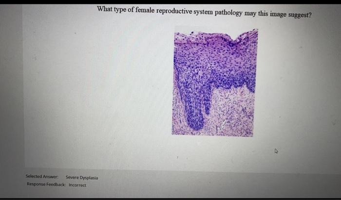 Solved What type of female reproductive system pathology | Chegg.com