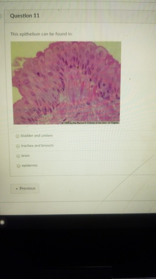 Solved Question 11 This epithelium can be found in 1999 | Chegg.com