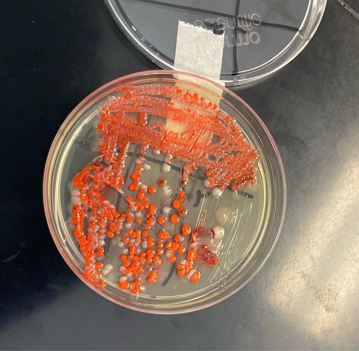 Solved 1) Closely examine colonies on your streak plates, | Chegg.com