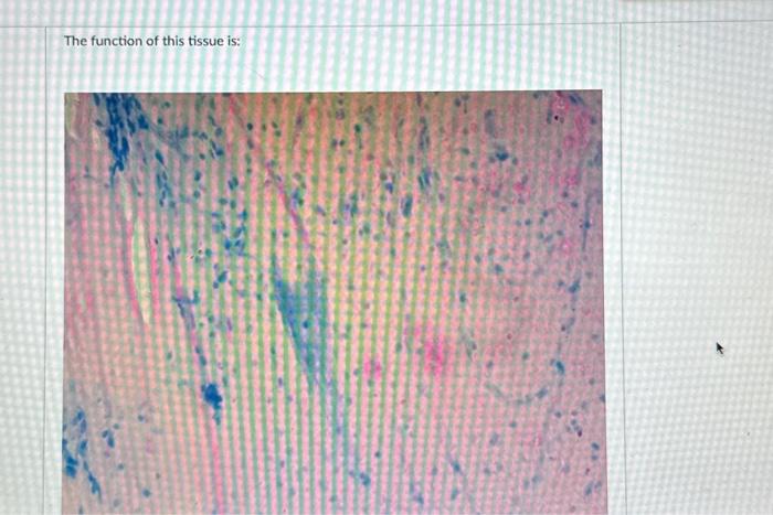 Solved The function of this tissue is: Movement Connecting | Chegg.com