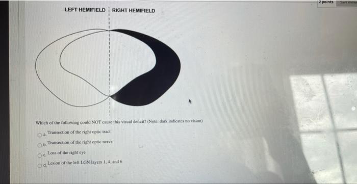 Solved z points LEFT HEMIFIELD RIGHT HEMIFIELD Which of the | Chegg.com