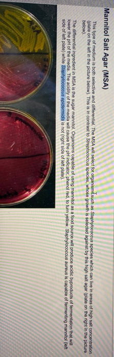 Solved Mannitol Salt 1. What is this media selective and | Chegg.com