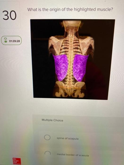 Solved What is the origin of the highlighted muscle? 30 | Chegg.com
