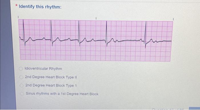 Solved Identify this rhythm: Idioventricular Rhythm 2nd | Chegg.com